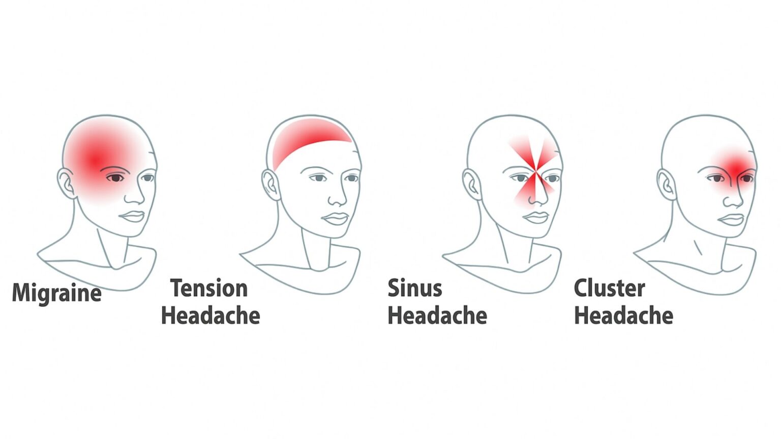 Neck Pain? Your Pillow Might Be the Hidden Cause